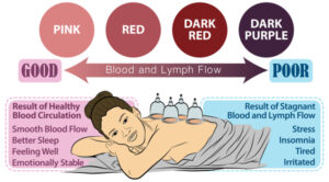 Cupping Color Chart - Why Does Cupping Leave Marks And What Are Their ...