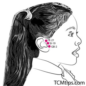 7 TMJ Acupressure Points And Learn To Relieve Headache Caused By TMJ ...