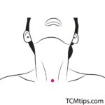 Free Face Acupressure Points Chart: 6 Acupoints That Help To Reduce ...
