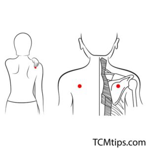 18 Proven Acupressure Points For Fibromyalgia Pain Relief - TCM Tips