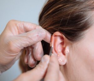 3 Ear Acupressure Points Charts For Effective Pain Relief - TCM Tips