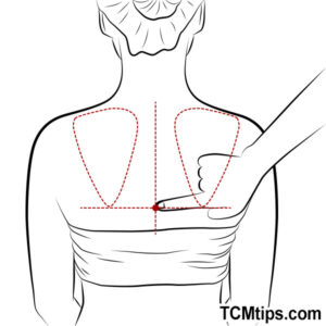 6 Great Acupuncture Points for GERD - TCM Tips