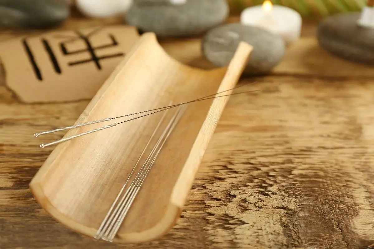 7 Best Acupuncture Clinics On Staten Island - Easy TCM Wisdom : Your ...