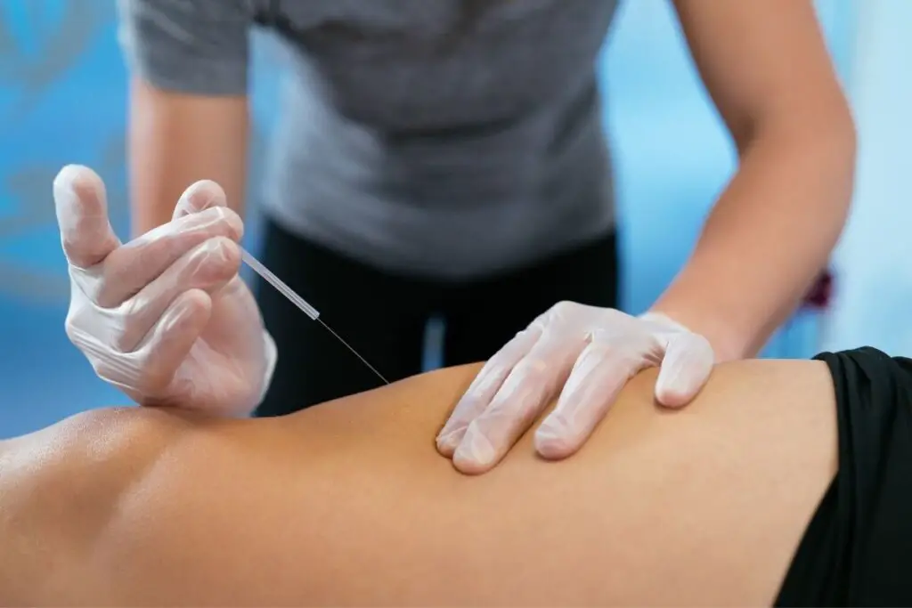 7 Best Acupuncture Places In Austin - TCM Tips