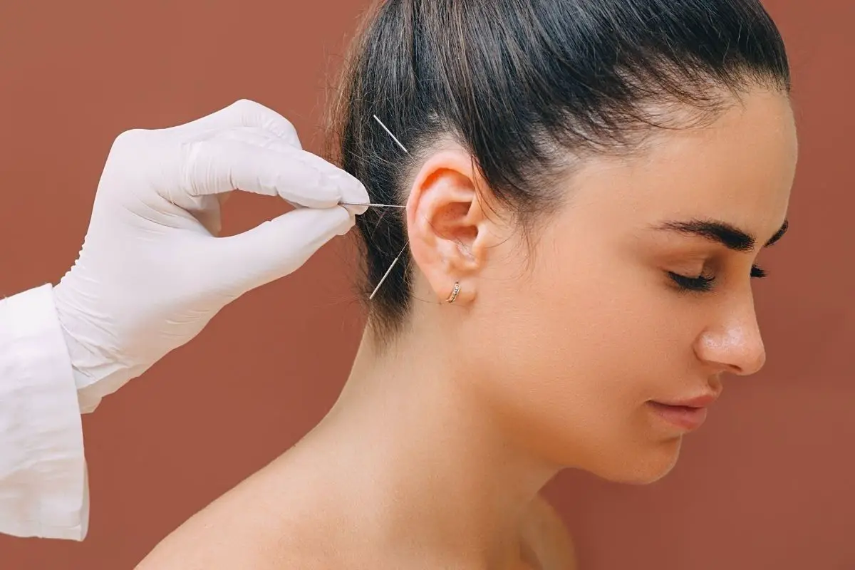 Best Acupuncture Places In Charlottesville - Easy TCM Wisdom : Your ...