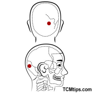 Glaucoma Acupuncture: An Alternative Treatment For Glaucoma Patients ...