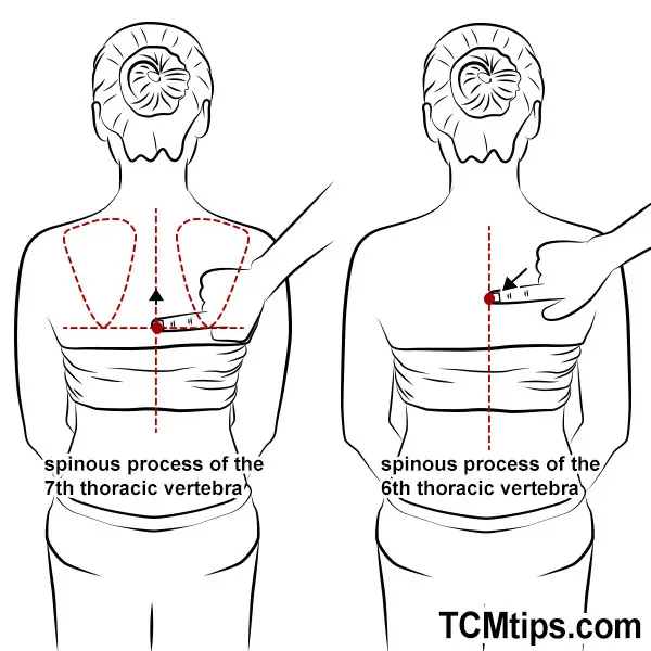 6 Great Acupuncture Points for GERD - Easy TCM Wisdom : Your Path to ...